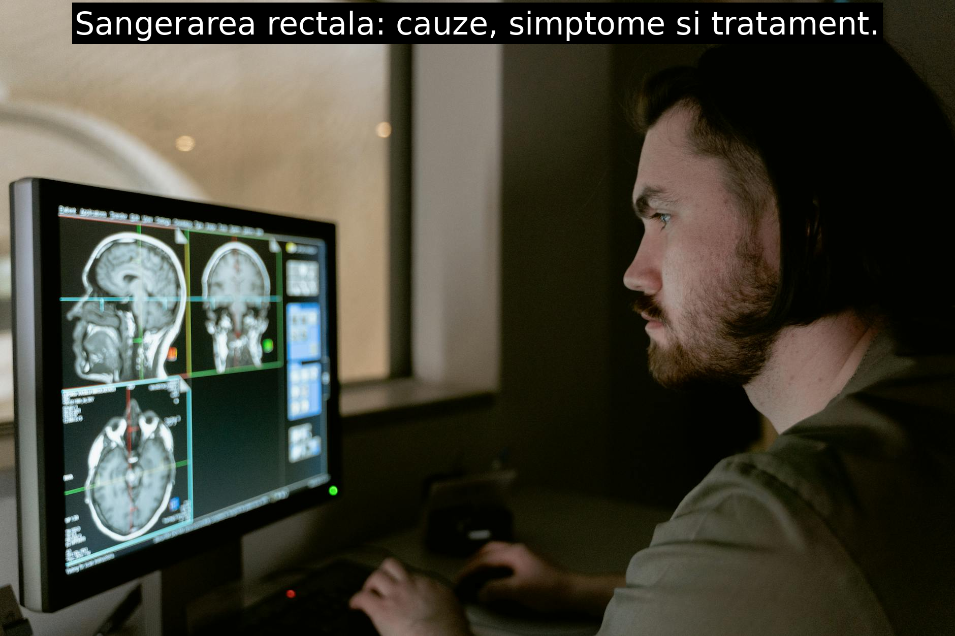 Sangerarea rectala: cauze, simptome si tratament. - Clinic Sanatos
